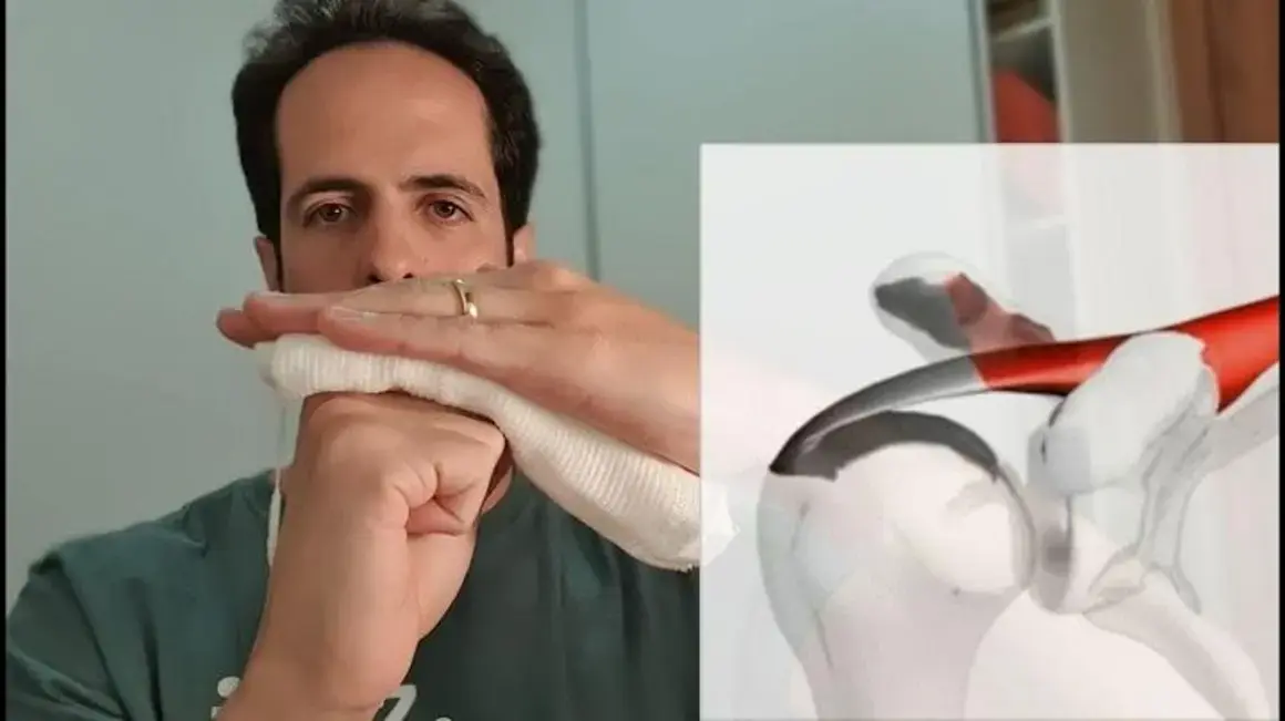 Receita de Tendinopatia do Supra Espinhal: Tratamento e Cuidados para Ombro